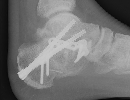 Management | The Bone School